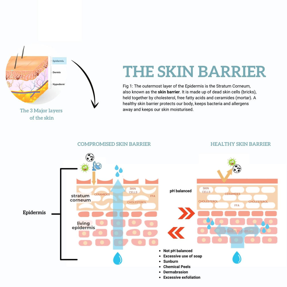 The Skin Barrier & Why It is Important – ellé derm